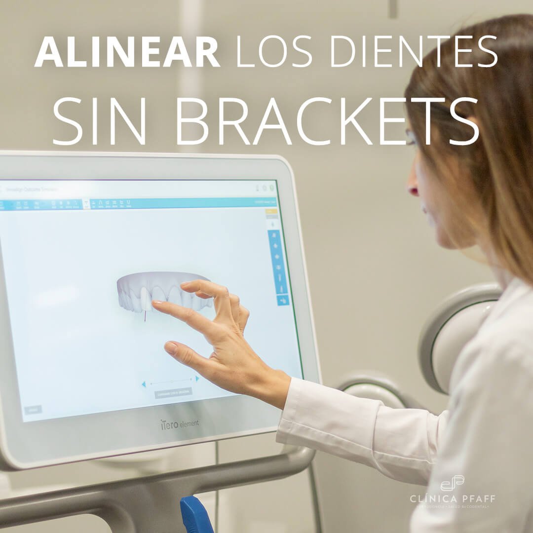 ¿Cómo se pueden alinear los dientes sin brackets? | Pfaff Clínica ...